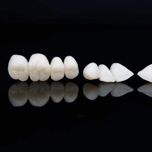 How do dental bridges and crowns differ from one another? | by River ...