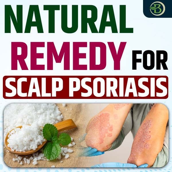 Permanent Solution for Psoriasis? Discover the Power of Nutrition ...