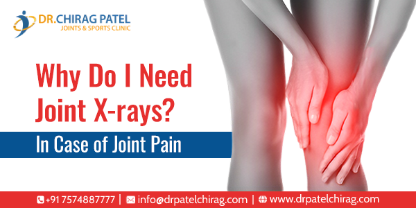 Importance of Joint X-ray in Diagnosing Joint Pain | by ...