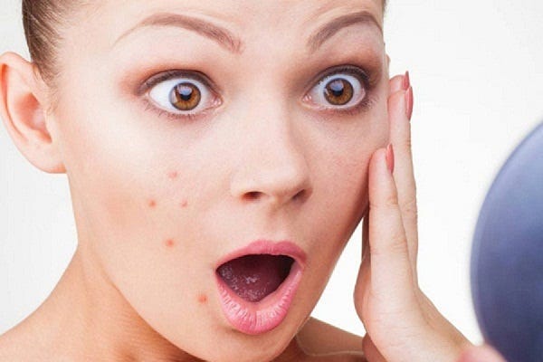 How To Remove Back Acne Scars. Back acne scars are the most disgusting ...