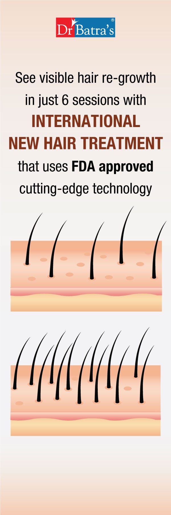 Hair Fall Treatment at Dr Batra’s Homeopathy Clinic - Pinki Kumari - Medium