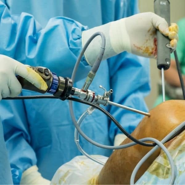 Arthroscopic Shoulder Surgery In Calgary | by Priya Sharma | Medium