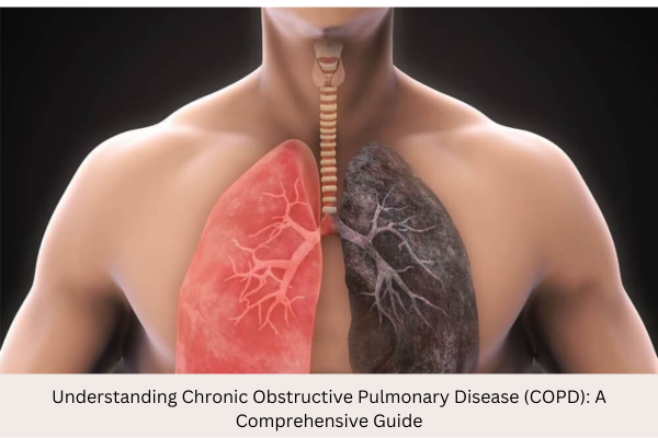 Understanding Chronic Obstructive Pulmonary Disease (COPD): A Comprehensive Guide | by well ...