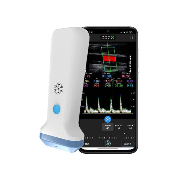 Classification of the Medical USG Transducer | by Stork | Medium