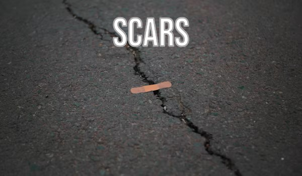 Scars. A simple tale of how the tragedies of… | by Mark Bennett | Jun ...