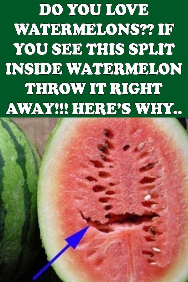 Do You Love Watermelons? If You See This Split Inside Watermelon Throw It Right Away! Here’s Why ...