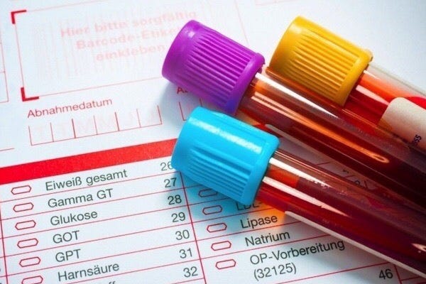 Como são realizados os exames bioquímicos atualmente? | by Nayra ...