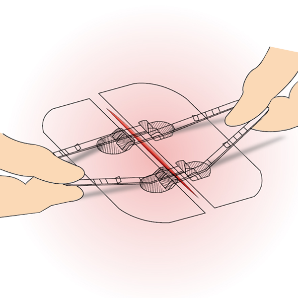 How to Apply and Remove Butterfly Wound Closures Properly | by Karla ...