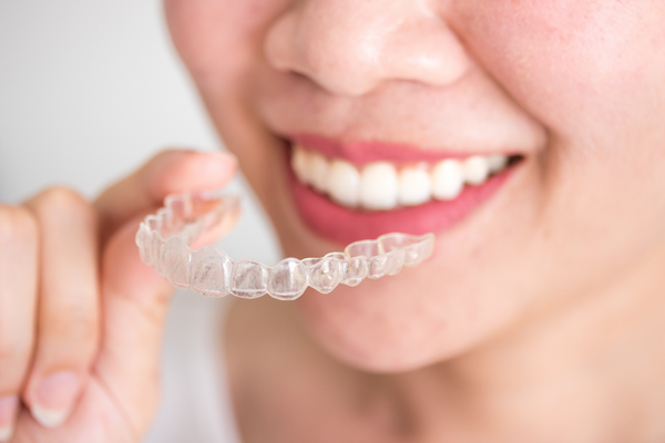 Invisalign in Orange County: A Revolutionary Orthodontic Treatment | by ...