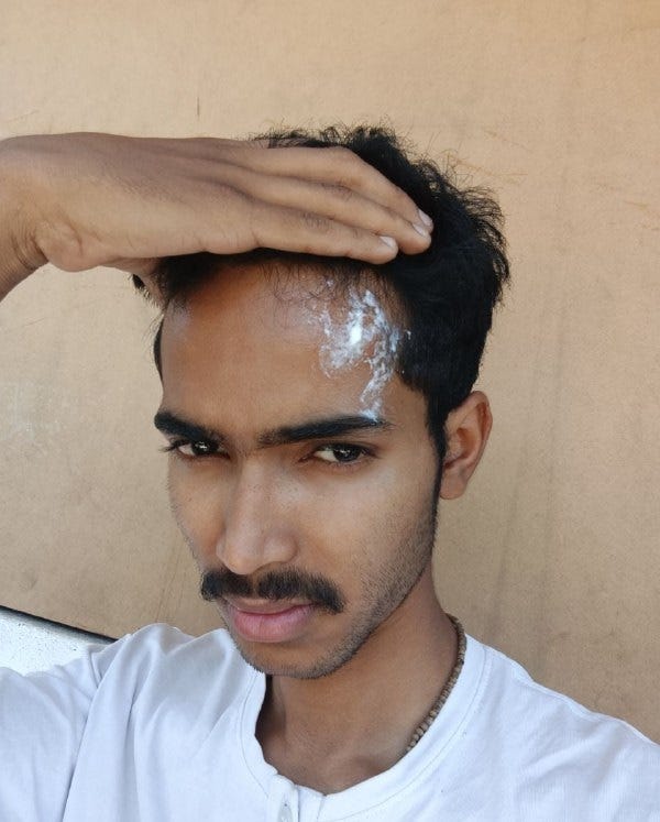 A Minor Accident. How I hit the back of the vechinal… | by May B Prince ...
