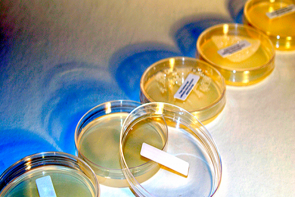Global Microbial Control Chemical Market Manufacturing Process Analysis ...
