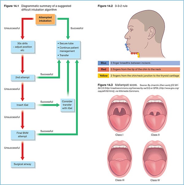 Cracking the Code of Advanced Airway Interventions: A Comprehensive ...