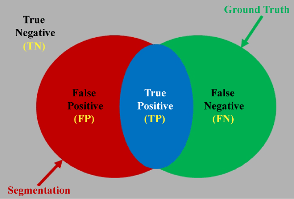 U-net Unleashed: A step-by-step guide on implementing and training your own segmentation model ...