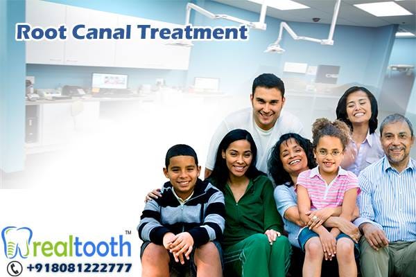 Navigating Root Treatment Costs: Understanding Your Options | by real ...