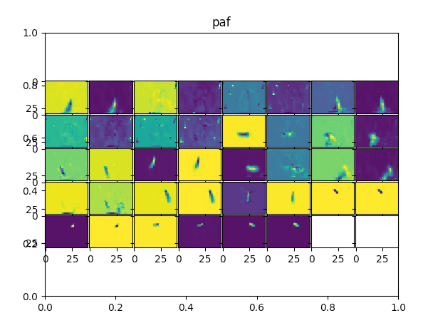 PoseResnet : A Top-down Machine Learning Model for Pose Estimation | by ...