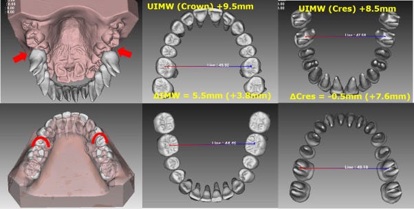 Orthodontics + AI: The Digital Bite | by Youth in AI | Aug, 2024 | Medium