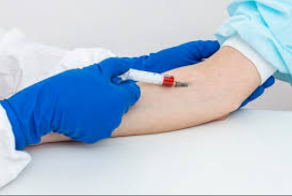 Ambulatory Phlebectomy: The Non-Surgical Solution for Varicose Veins ...