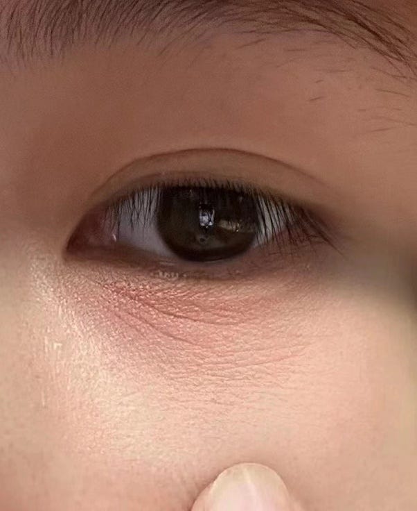 I only realized it after using it — eye cream is not a scam! | by ...