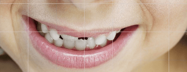 The Connection Between Calcium Deficiency and Tooth Loss Explained | Medium