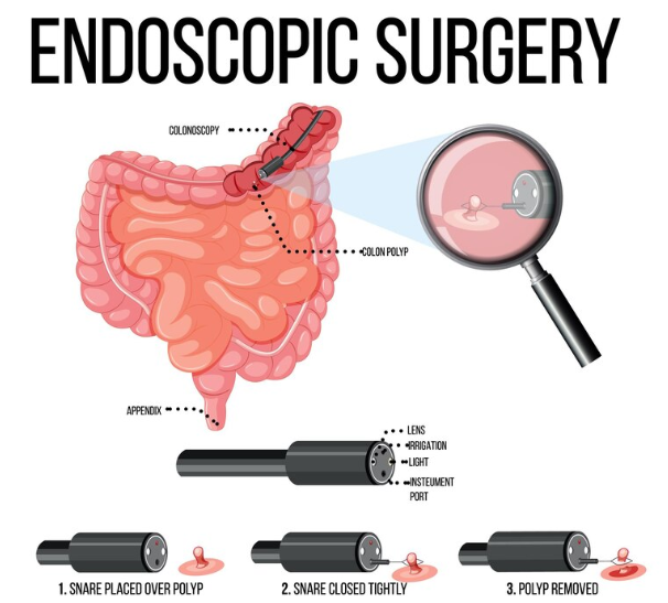 Who is the best endoscopy in India? | by Dr. Sawan Bopanna | Apr, 2024 ...