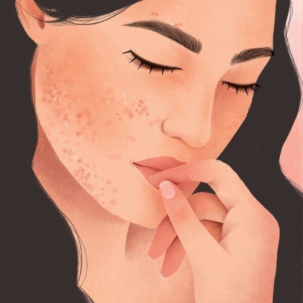 Treat your Acne with Love. Acne is a common skin condition that… | by ...