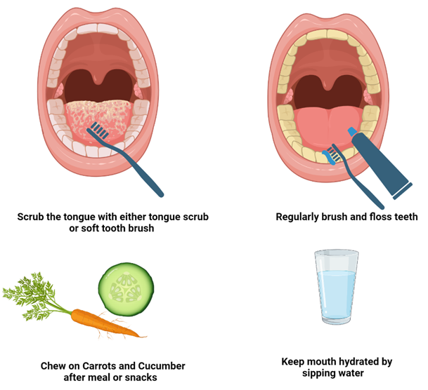 BAD BREATH (HALITOSIS) IN CHILDREN- CAUSES AND CARE | by Dr Kausar S ...