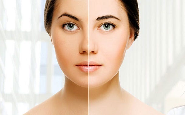 A Guide to Safe and Effective Skin Whitening Treatments | by Ibmohit ...
