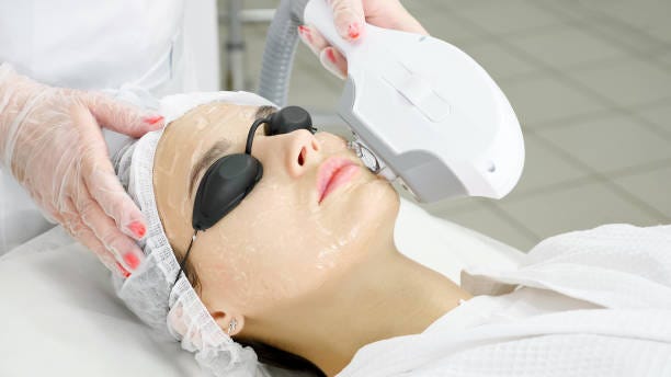 Cryofacial for Acne: A Revolutionary Treatment for Clearer Skin | by ...