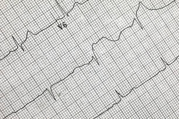 Decoding the Feeble Pulse: Understanding Causes and Implications | by ...