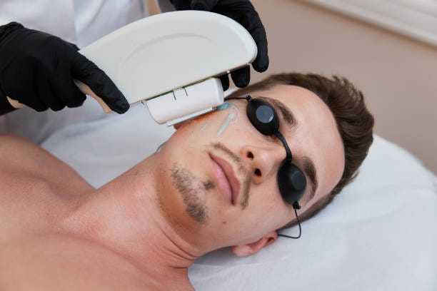 The Ultimate Grooming Solution: Beard Laser Hair Removal in Abu Dhabi ...