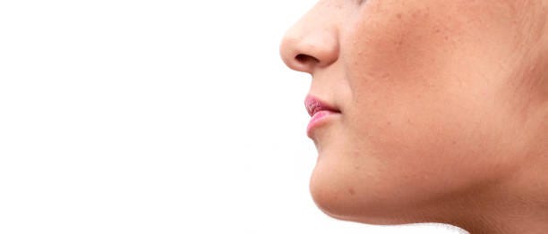 Nose Sculpting Renaissance: The Unique Artistry of Nose Fillers in Doha ...