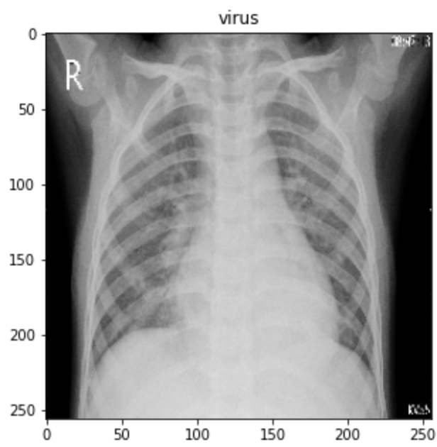 Building an AI disease diagnosis algorithm | by Ahmad Syahmi | Medium