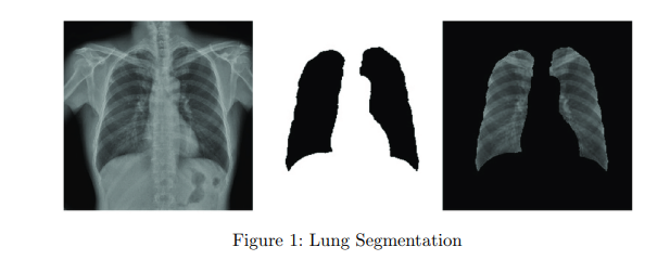 Evaluating effect of lung segmentation on disease prediction | by ...
