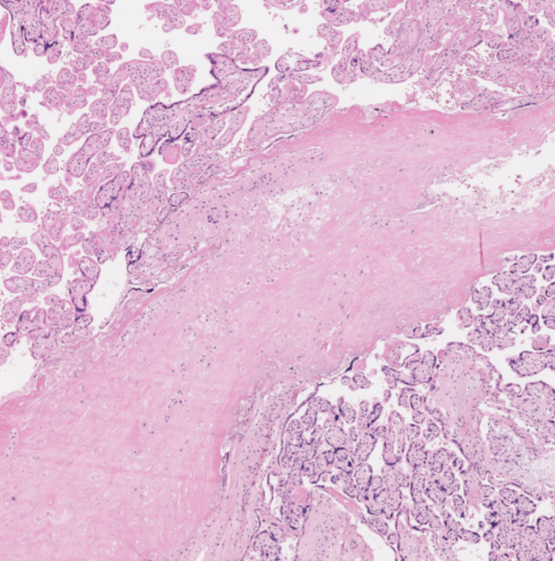 Object Detection in H&E Stained Histology Slides | by Morgan Lynch | Medium