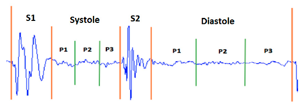 Review — Automatic Segmentation And Classification Of Heart Sounds Using Modified Empirical
