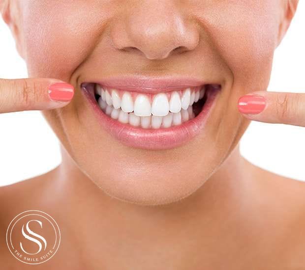 Get That Perfect Smile | Expert Gum Contouring at The Smile Suite - The ...
