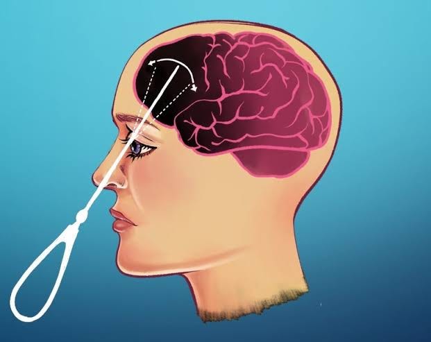 Psychiatry’s Greatest Sin: The Lobotomy Files | by Dr Wajiha Ali | Medium