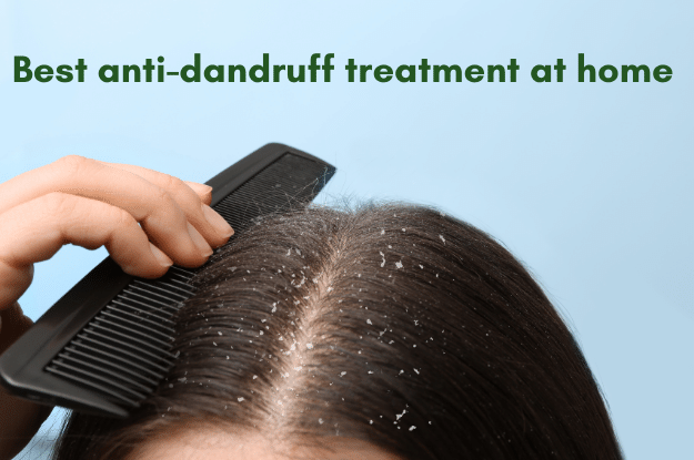 How to Remove Dandruff at Home?. Tired of those tiny white snowflakes ...