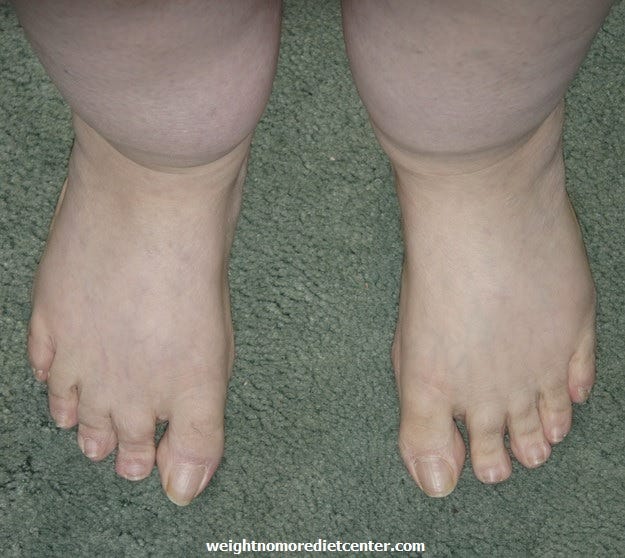 Take a Load Off Your Feet. As people get heavier, they are… | by Lori ...