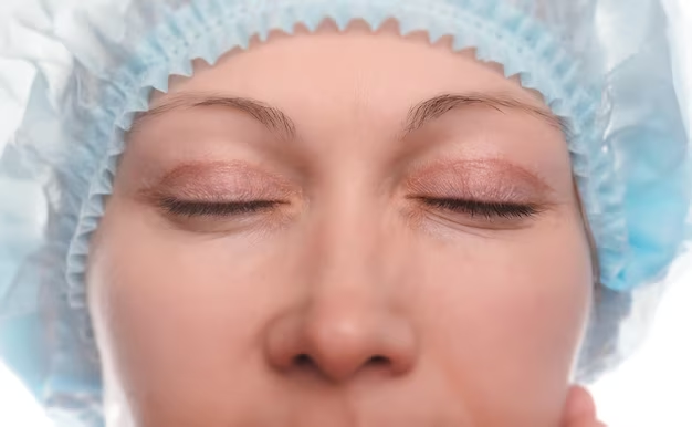 Eyes Wide Open: Understanding the Benefits of Upper Eyelid Surgery for ...