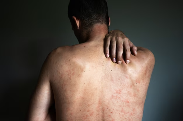 Dare to Bare: Get Your Back Summer-Ready by Solving Common Skin ...