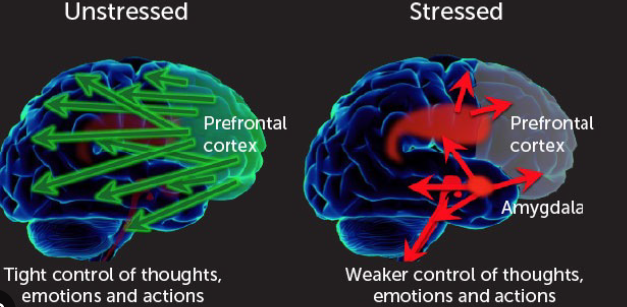 How Stress affects The Human Brain | by Marie Sabrina | May, 2025 | Medium