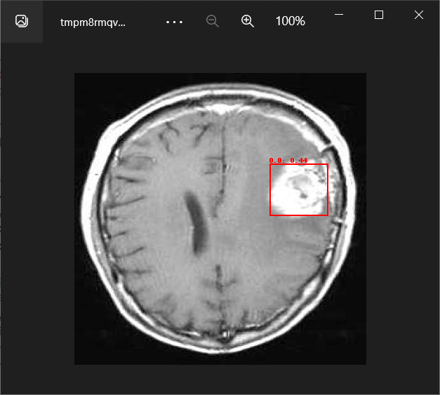Tutorial Object Detection Brain Tumor Mri Menggunakan Yolo You Only Look Once By Ai