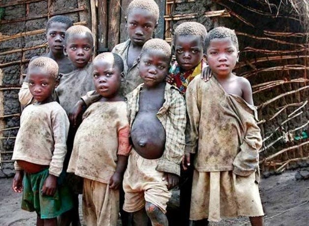 How poverty destroy man’s health: | by Sehrishbutt Butt | Medium