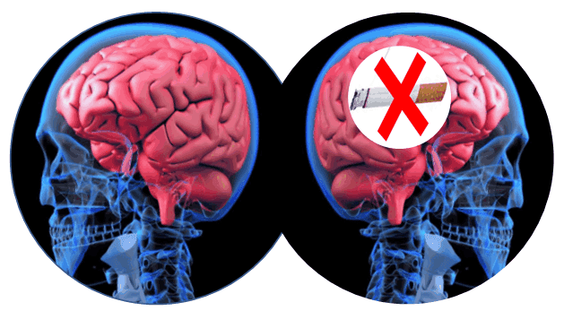 Can smoking cause memory loss? - Prem - Medium