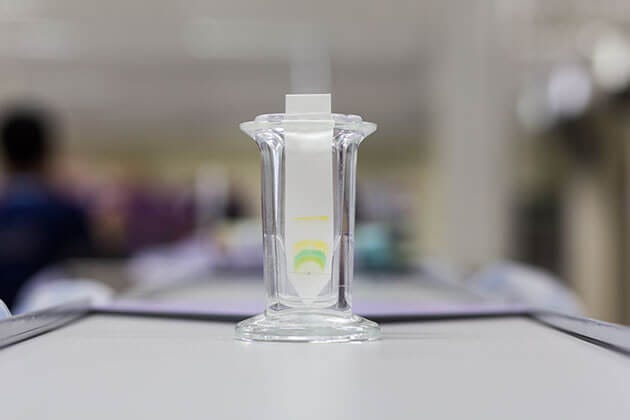 Chromatography is a Technique for Separation: Explain | by Thar Process ...