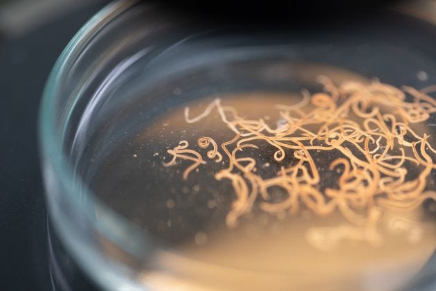 Small Intestinal Nematodes- Ascaris lumbricoides | by Kumuthu ...