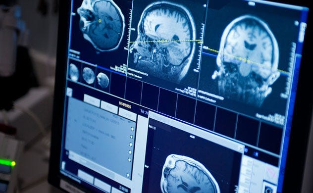 Computer science students for Brain tumour research and diagnosis | by Ranadeep Bhuyan | Medium