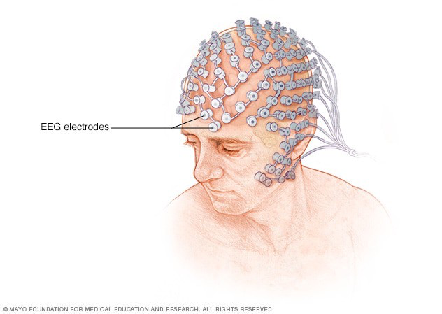 An intro into BCI’s. The concept of Brain Computer… | by Qais Chatur ...