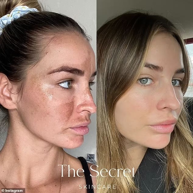 Unlock Clearer Skin: The Ultimate Guide to Pigmentation Treatment and ...